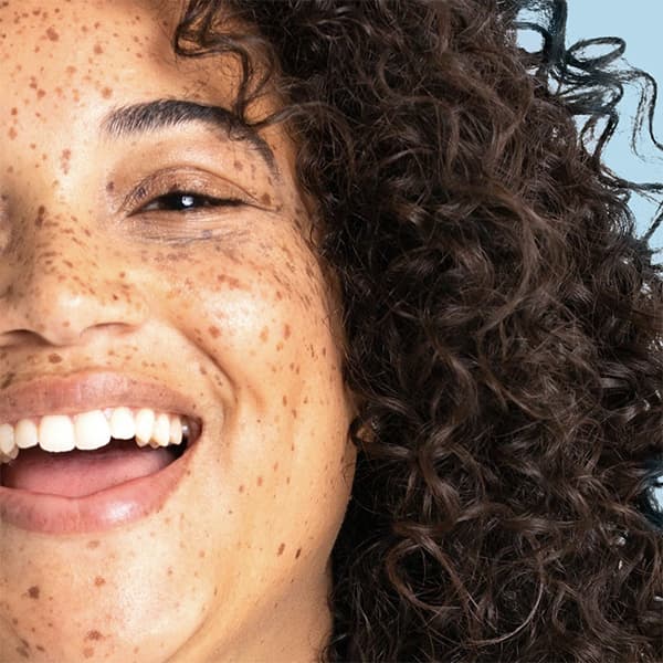 Skin + Me - Personalised skin treatment to treat acne and skin-ageing.